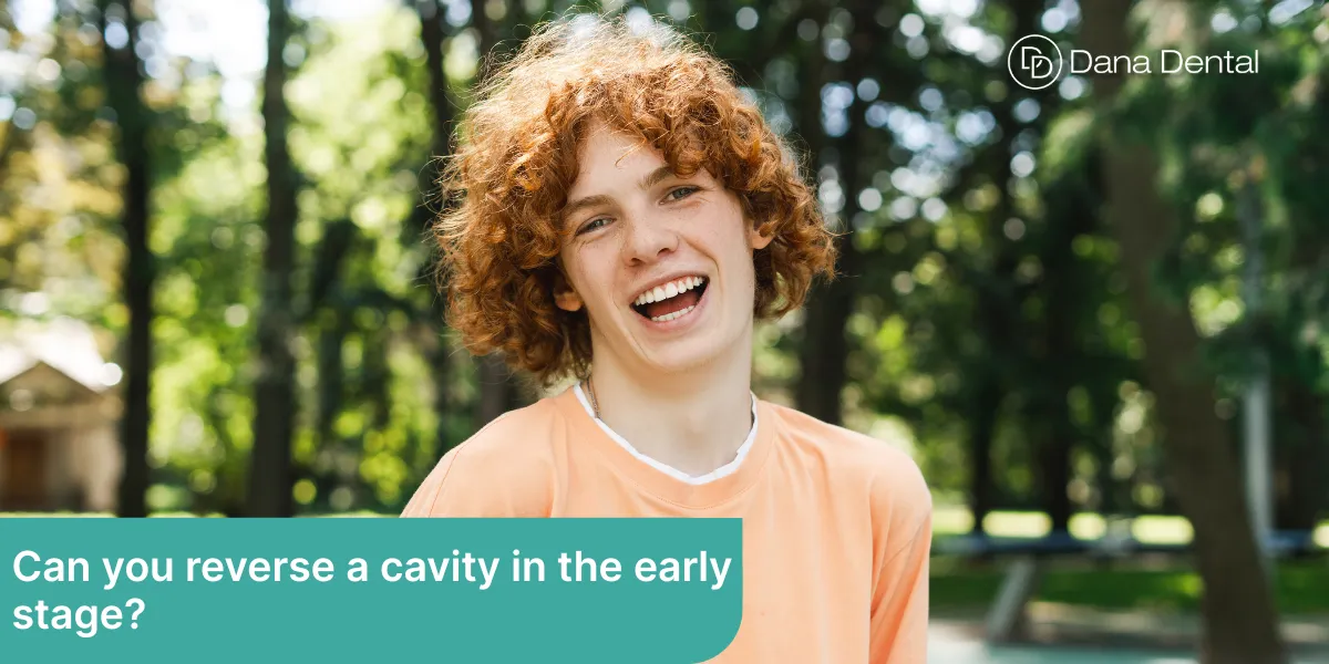 What Does A Cavity Look Like When It First Starts? | Aurora Dentist